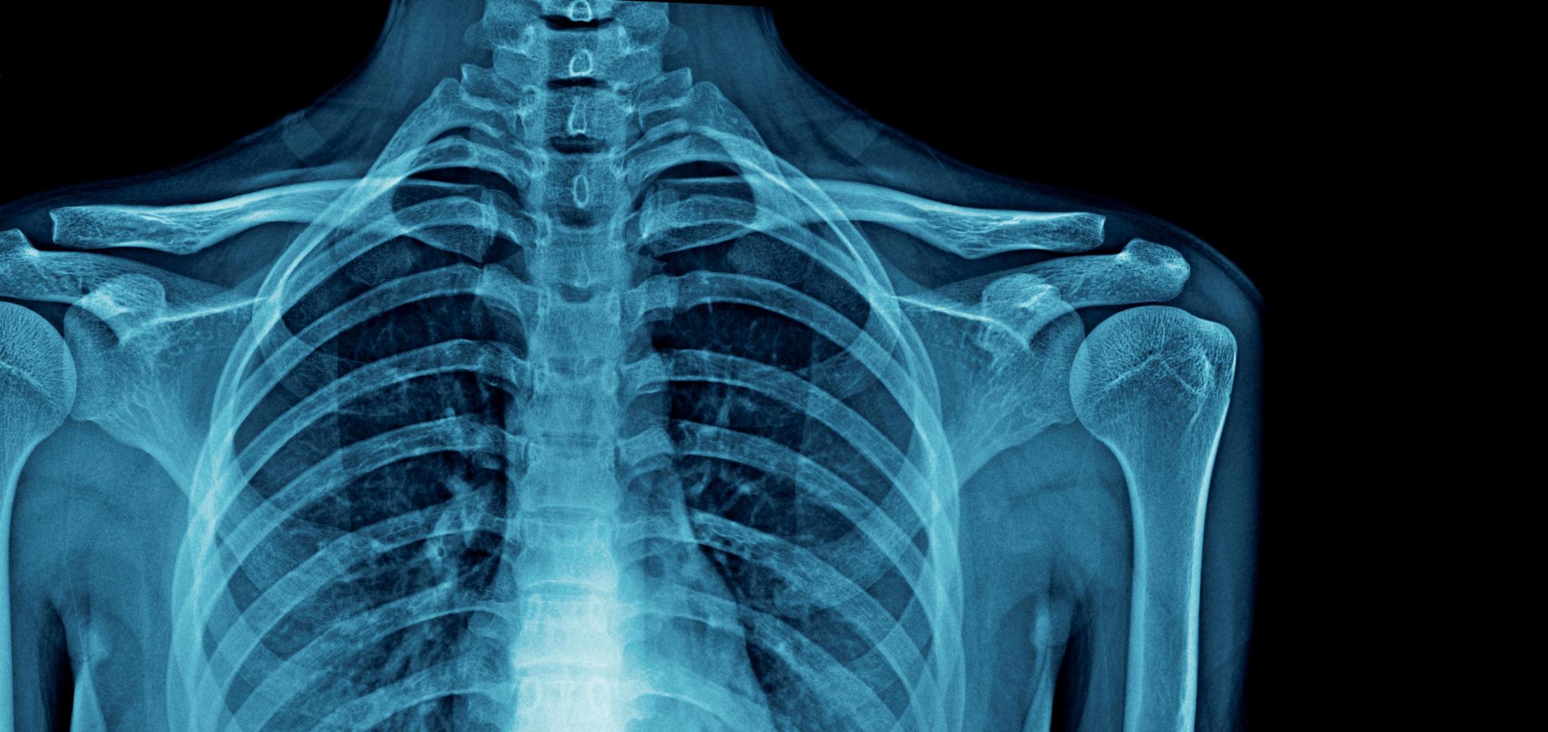 Radiologic Technology